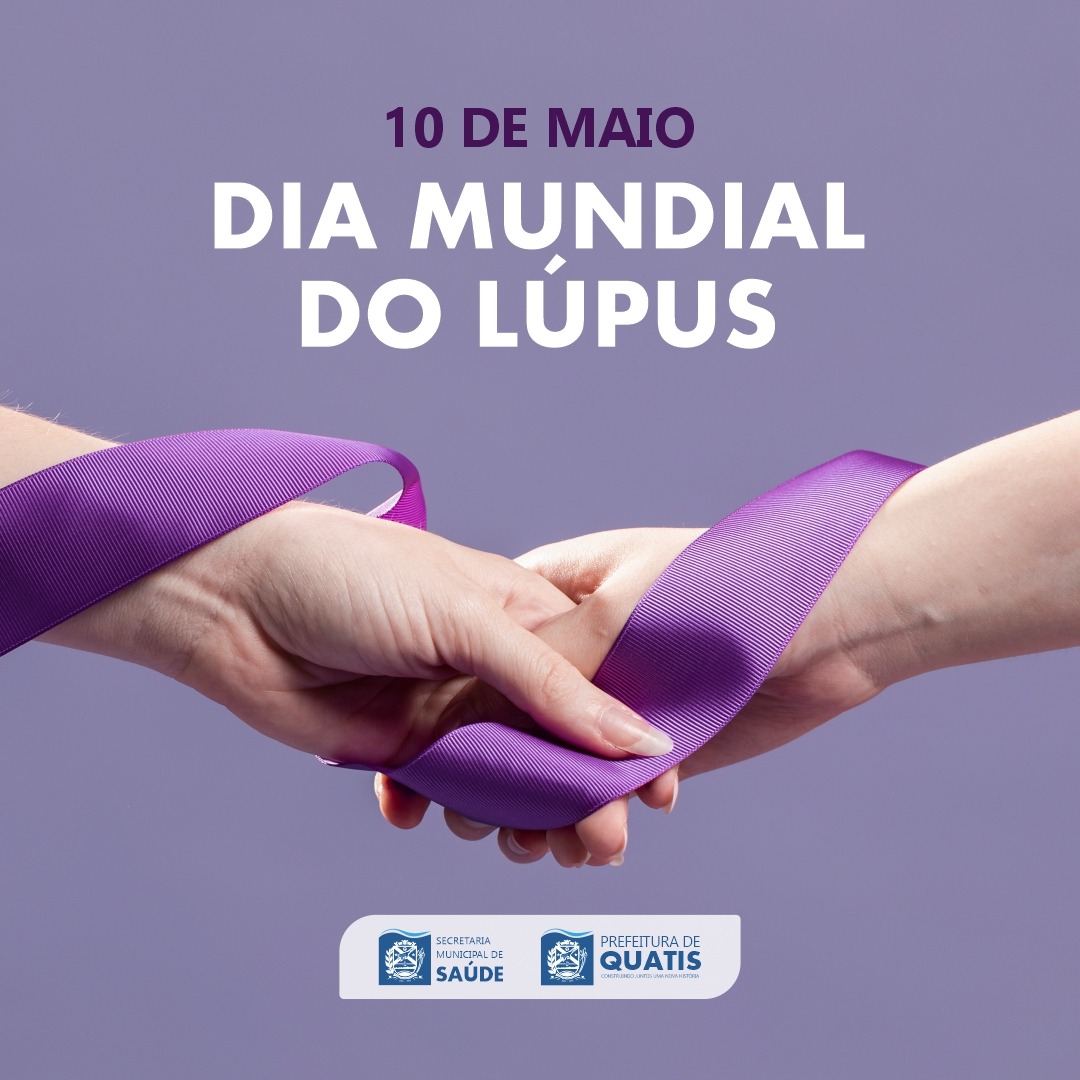 10 DE MAIO - DIA MUNDIAL DO LÚPUS – Prefeitura Municipal de Quatis